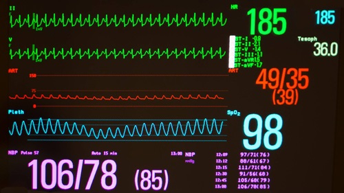 Heart conditions treated by Dr Segal | Dr Oliver Segal Heart conditions treated by Dr Segal | Dr Oliver Segal